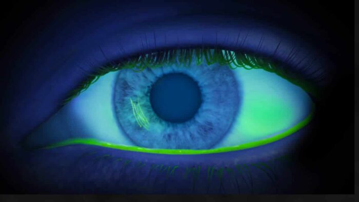 Corneal Scratch Treatment: How to Heal a Scratched Eye