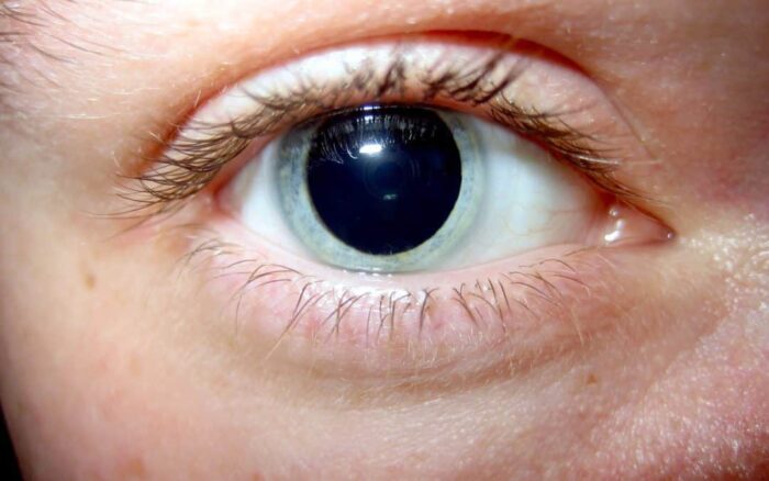 Pupil-Dilating Eye Drops: Uses, Procedure, Duration, and Side Effects