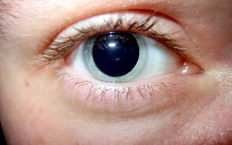Pupil-Dilating Eye Drops: Uses, Procedure, Duration, and Side Effects