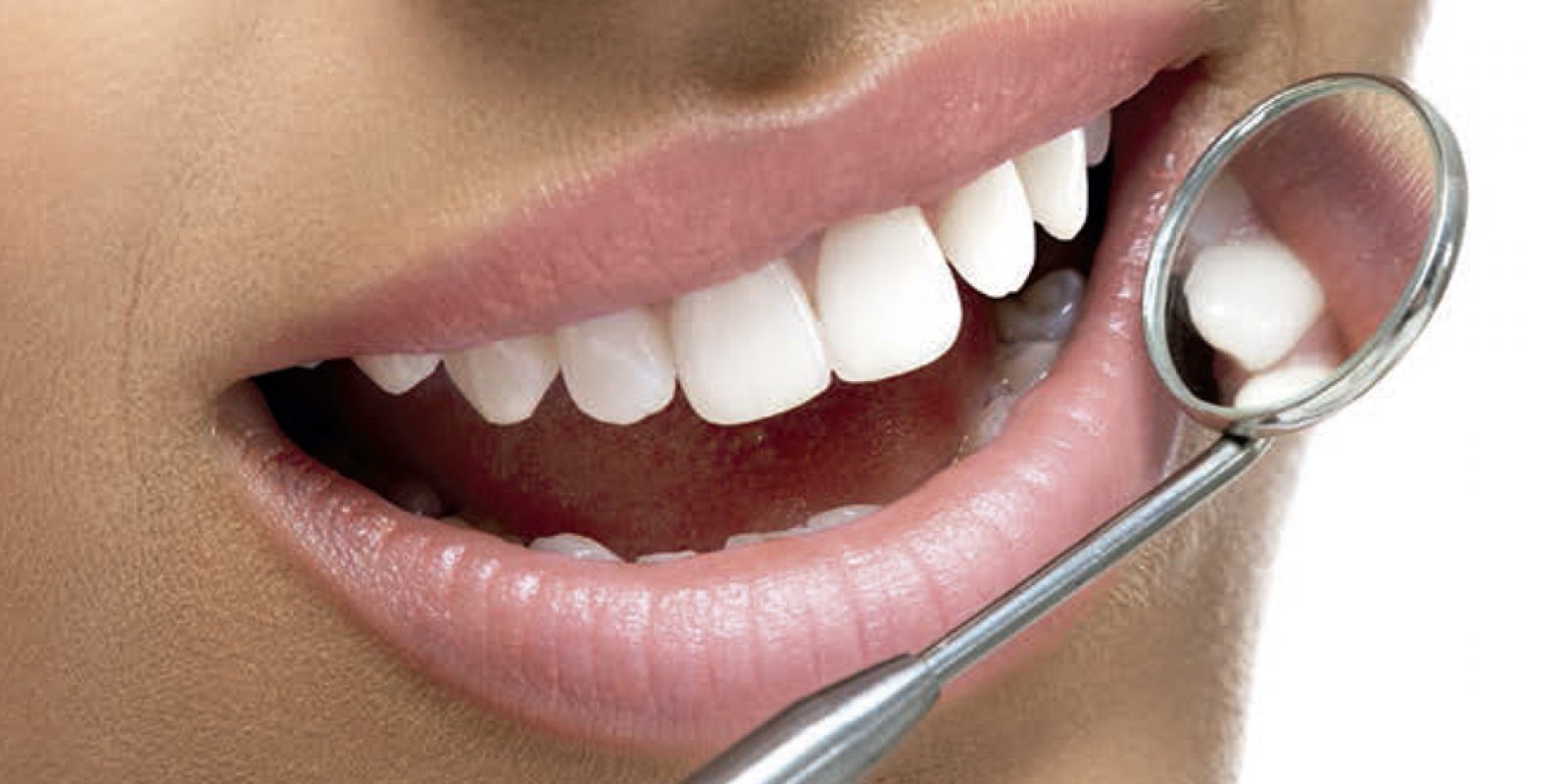 Tooth Decay: Causes, Symptoms, Treatment & Prevention Tips