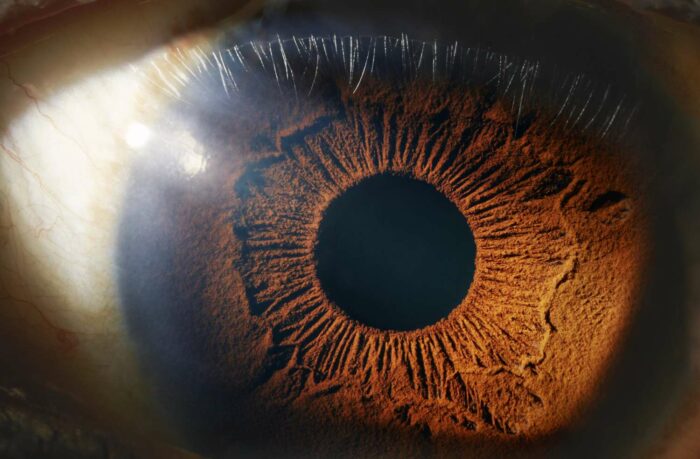 Pupil Dilation: Causes, Symptoms, Treatment & When to See a Doctor