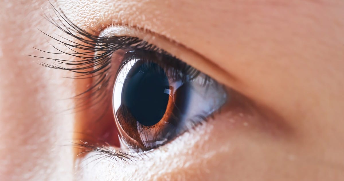 Corneal Transplant Surgery: Types, Procedure, Recovery, and Images