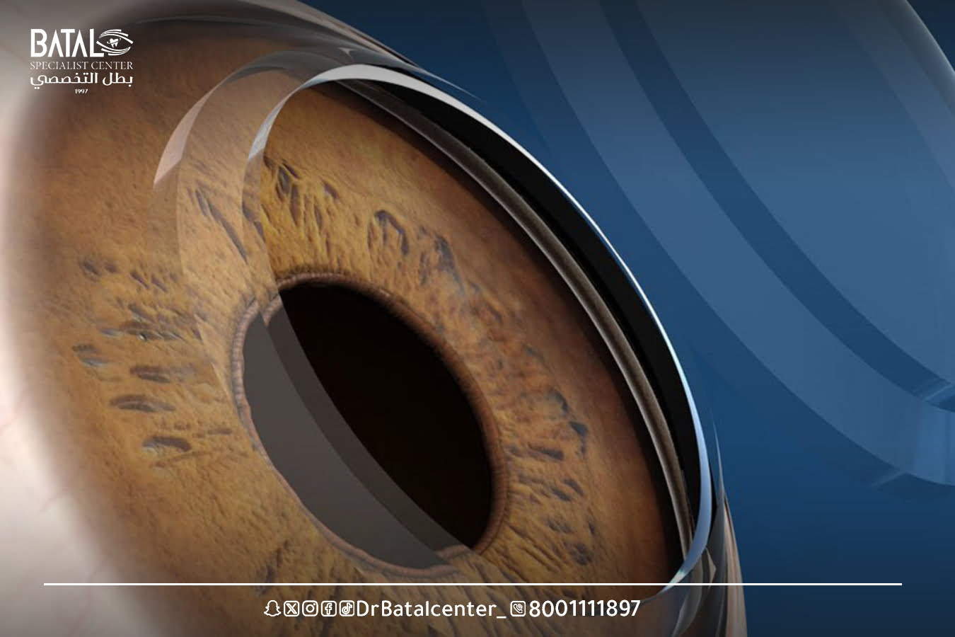 Fundus Examination: What It Is, How It’s Done, and What It Reveals ...