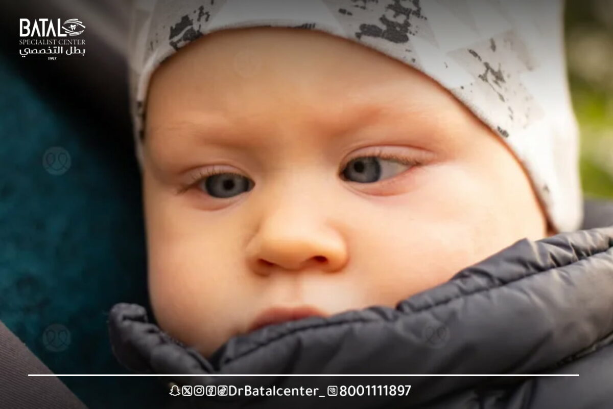 Strabismus Treatment in Children: Best Methods to Correct Eye Alignment ...